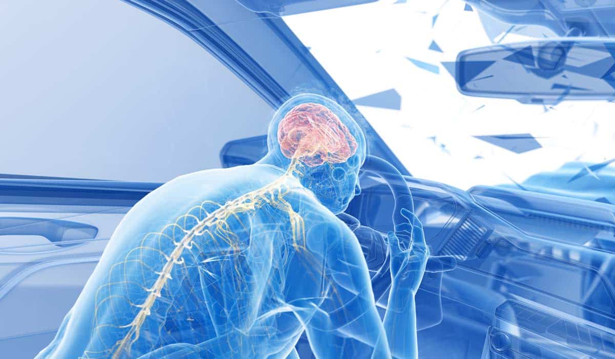 The Long Road Ahead: Recovering from a Car Accident Brain Injury | TBI